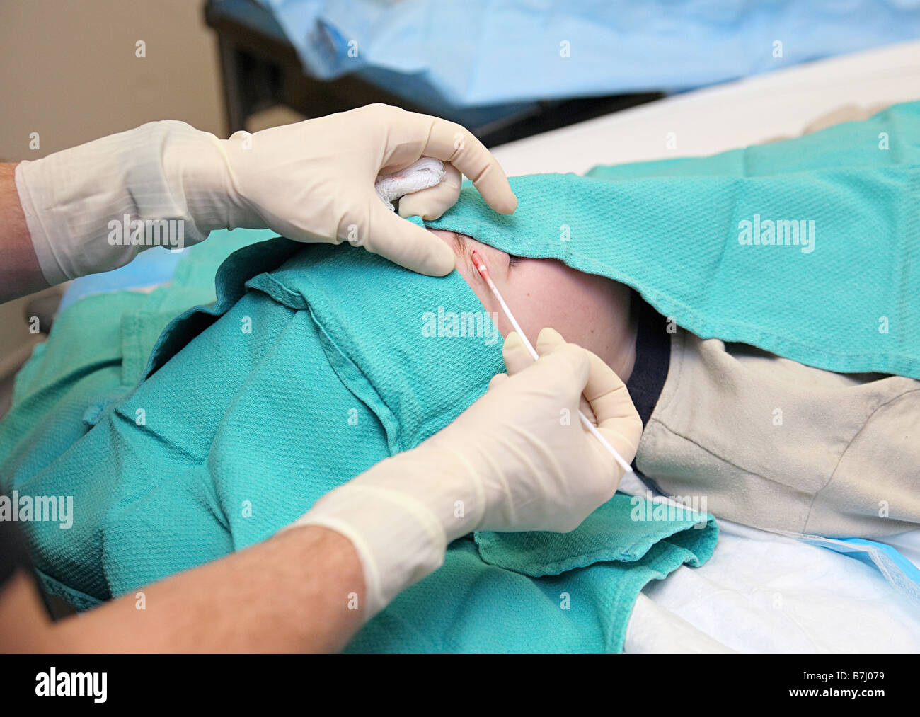 Boy hospital stitches care child hi-res stock photography and images ...