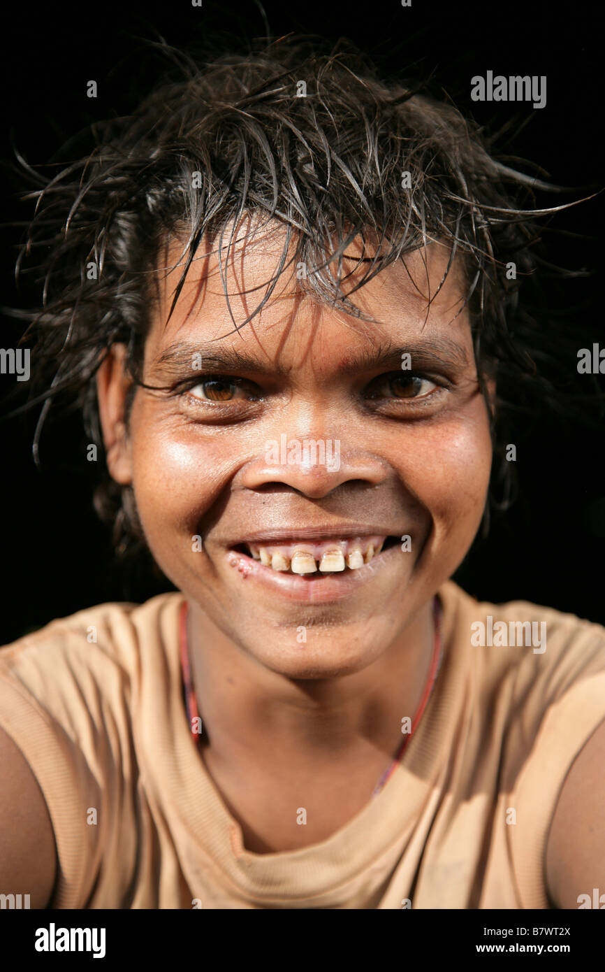 Boy gappy teeth Stock Photo - Alamy