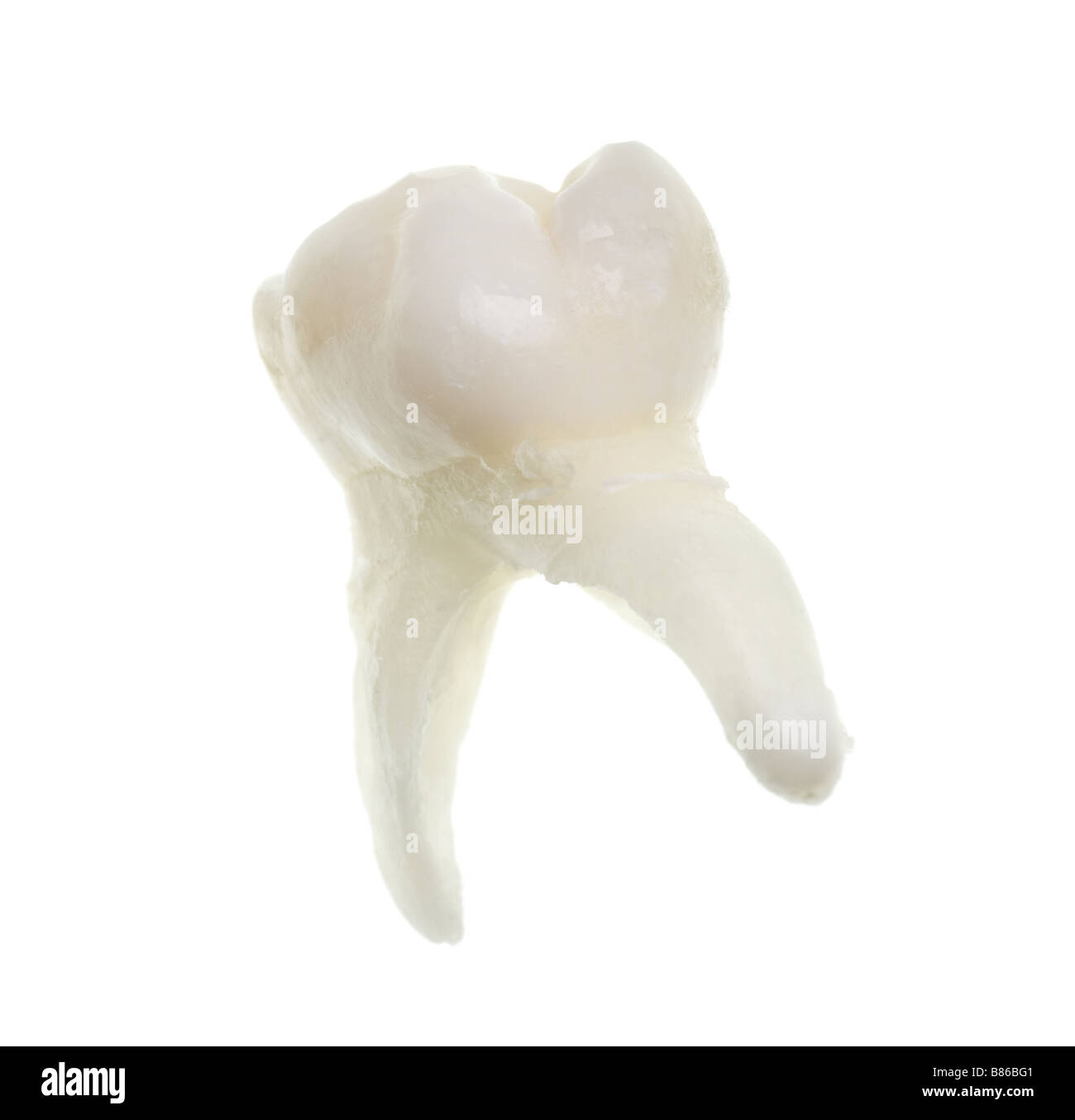 Molar Tooth High Resolution Stock Photography and Images - Alamy