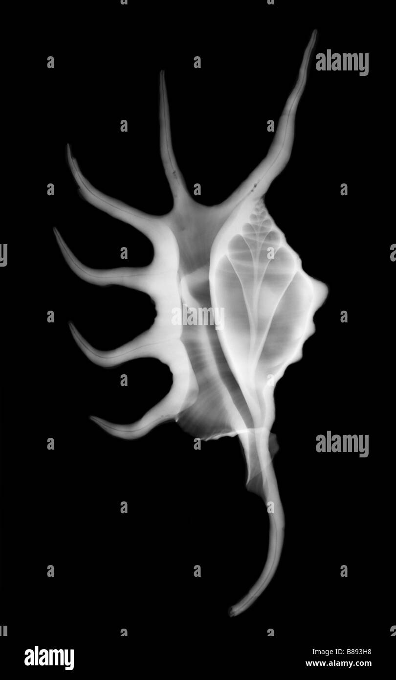 X ray of a Spider Conch Lambis sp shell Stock Photo - Alamy
