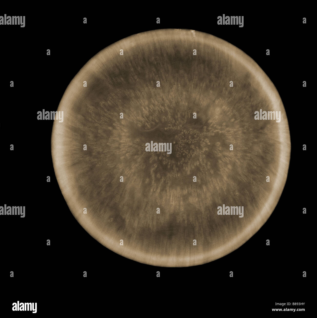 Xray x ray xrays x rays hi-res stock photography and images - Alamy