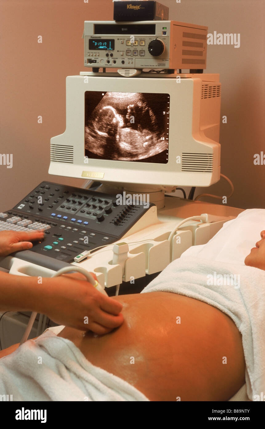 Doctor look screen ultrasound equipment hi-res stock photography and ...