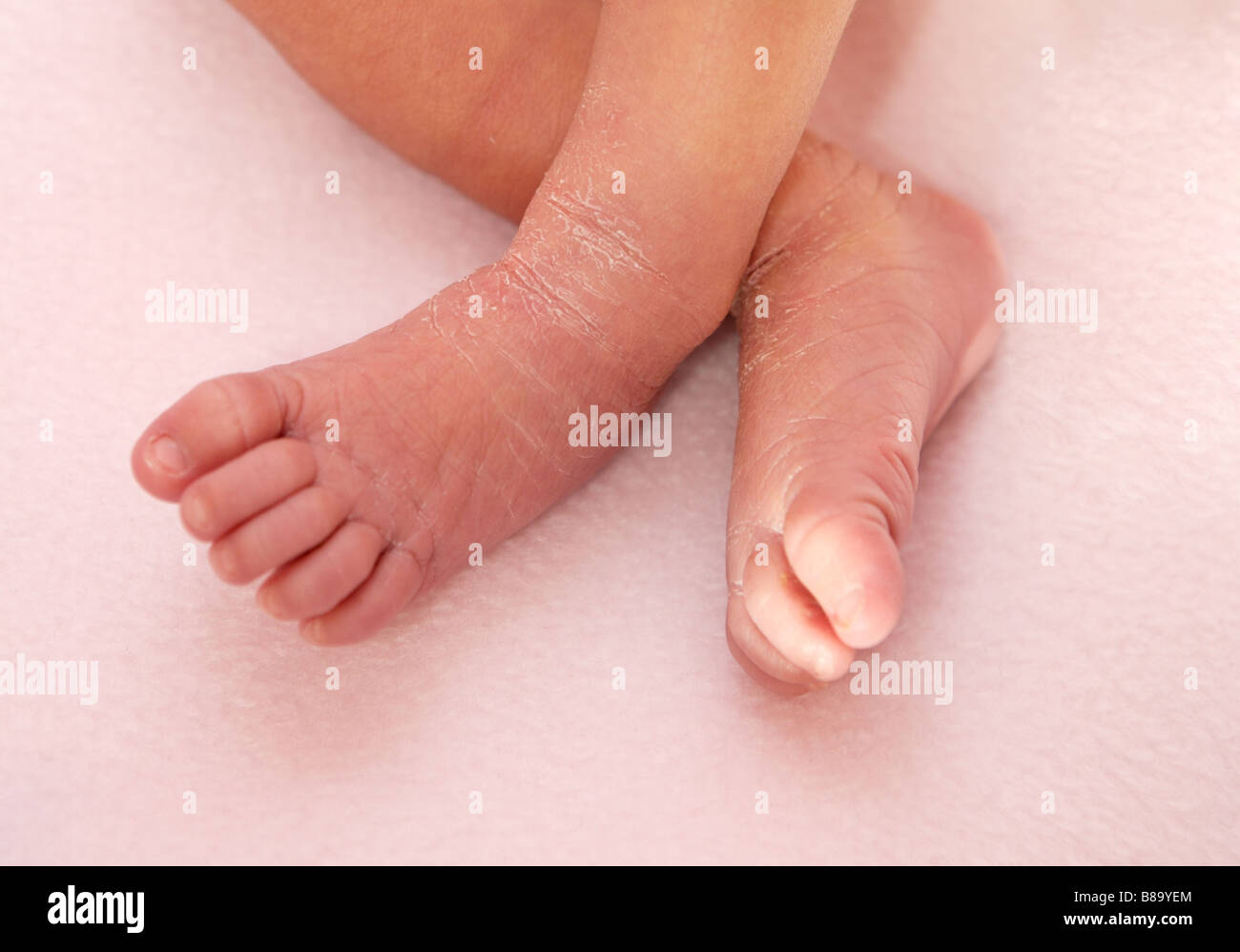a baby toes a over pink background Stock Photo - Alamy