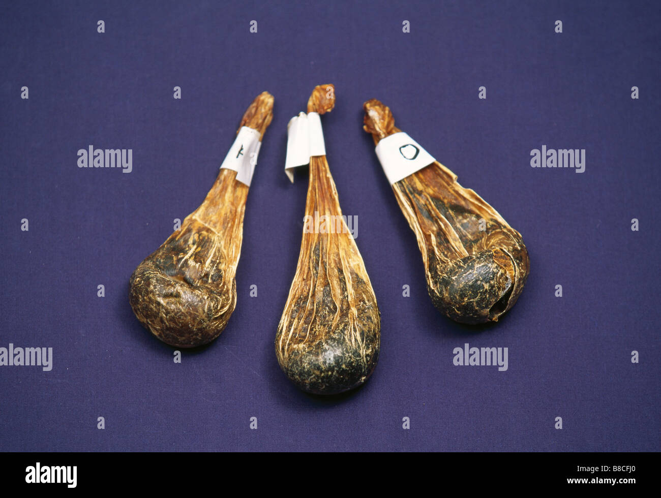 Gall bladders hi-res stock photography and images - Alamy