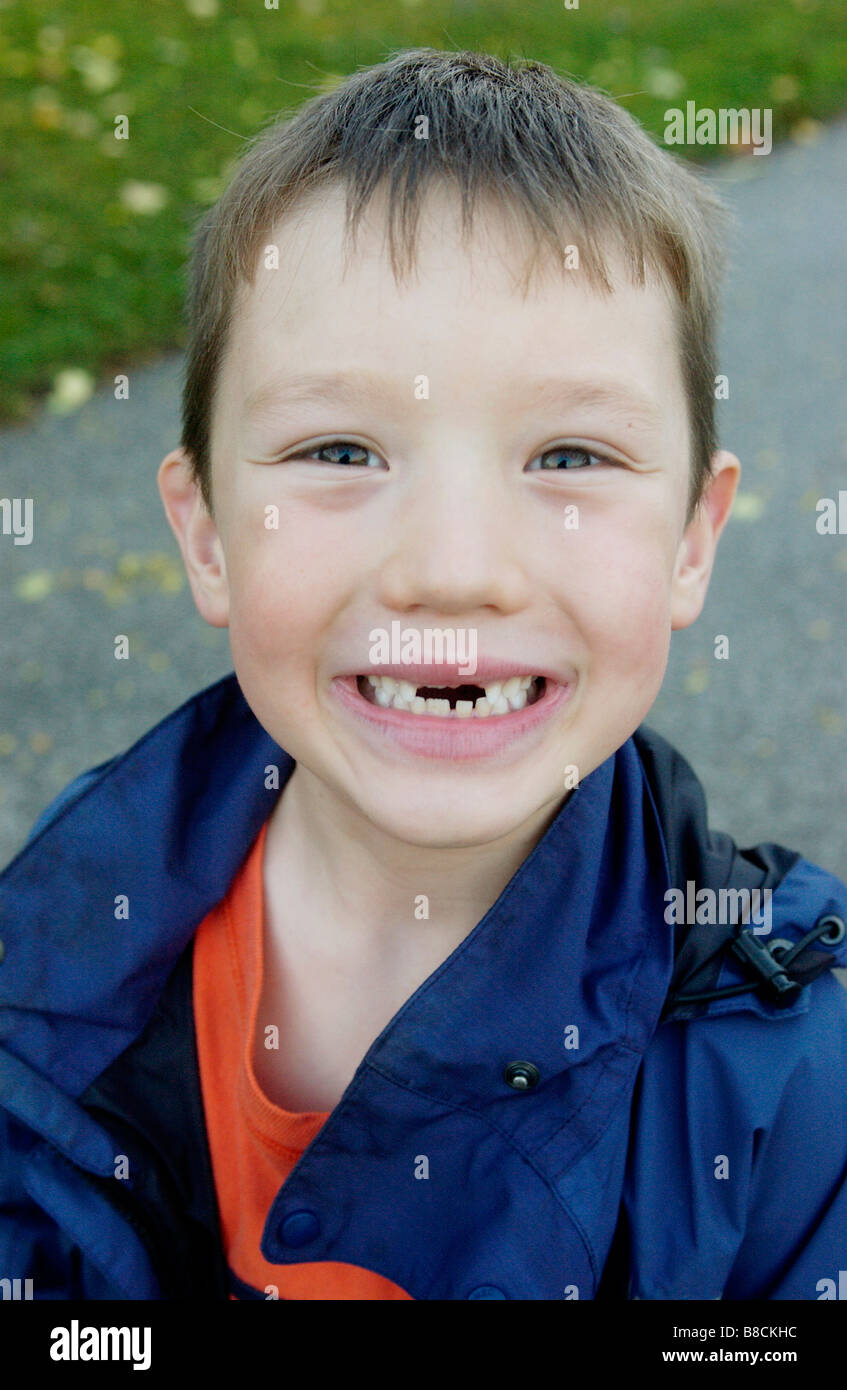 Boy Missing Teeth Smiling Stock Photo - Alamy