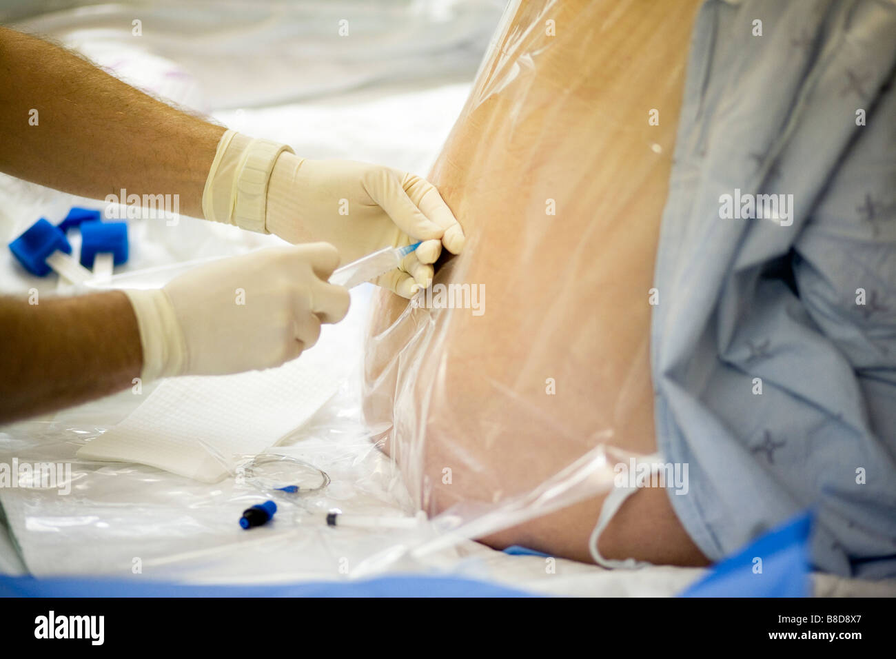 Pregnant Woman Receiving an Epidural Stock Photo - Alamy