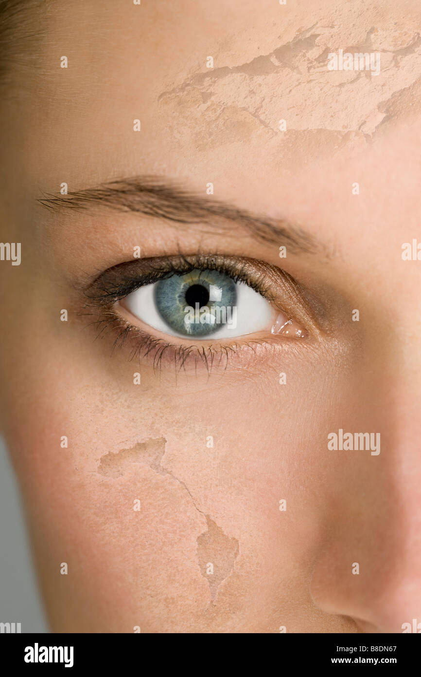 Dry cracked skin hi-res stock photography and images - Alamy