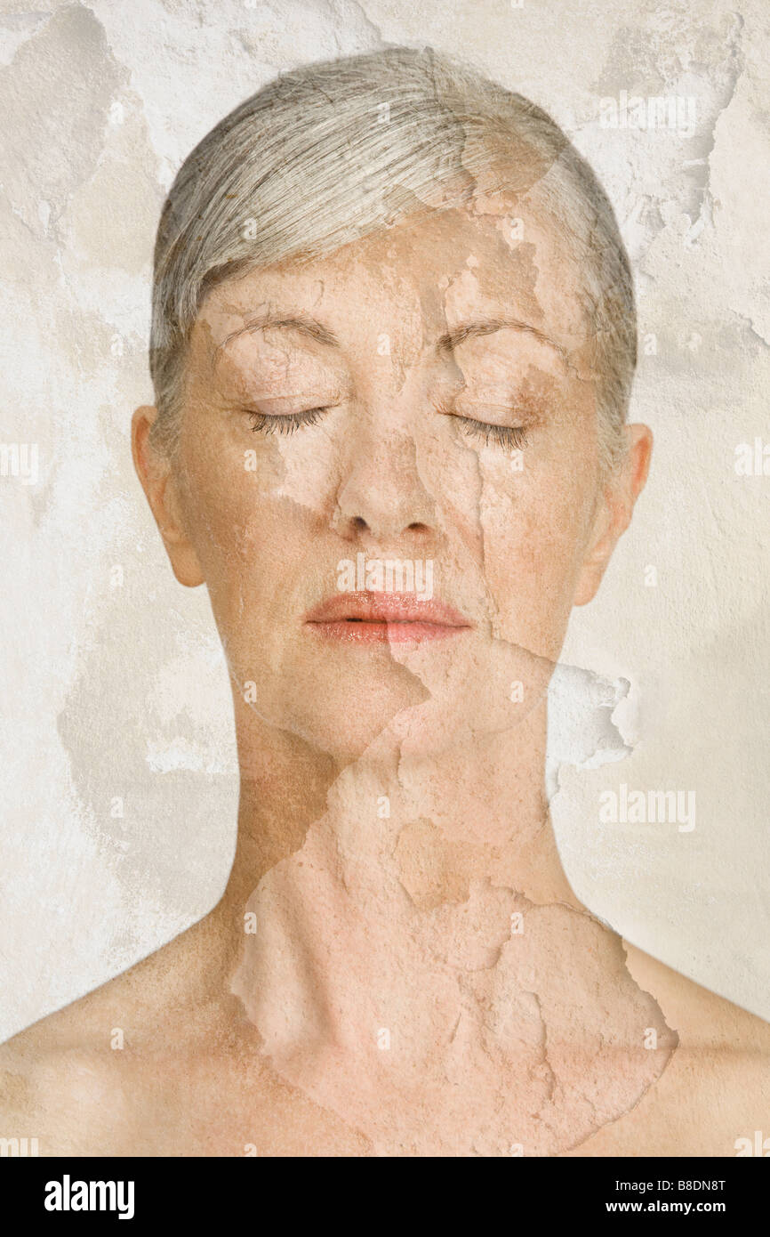 Woman with cracked and peeling skin Stock Photo - Alamy