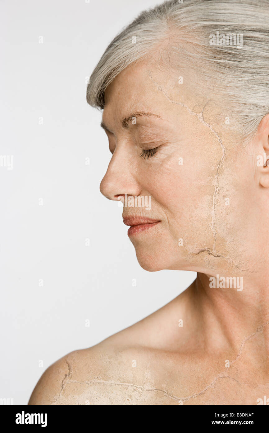 Woman with cracked and peeling skin Stock Photo - Alamy