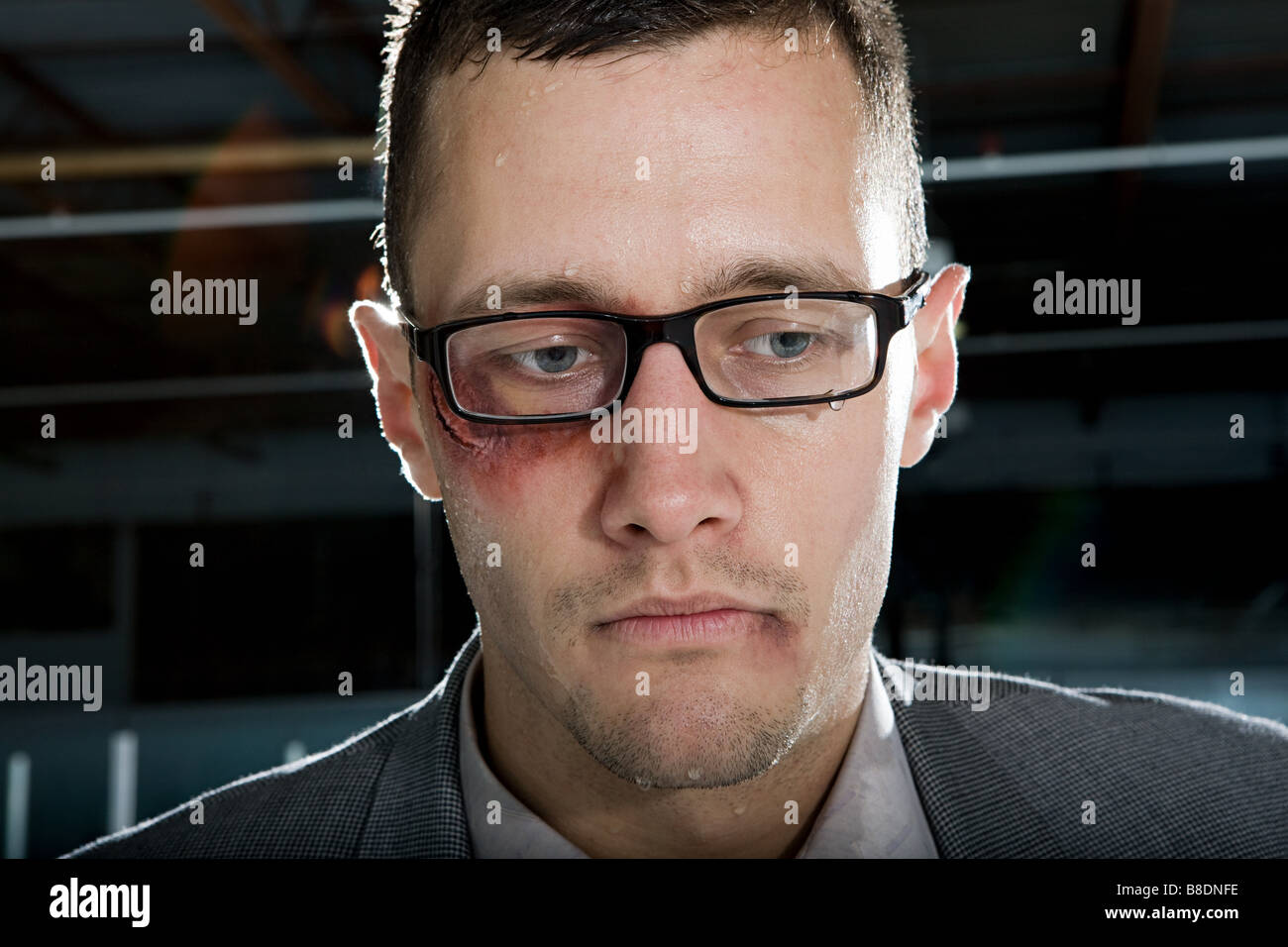 Businessman with bruised face hi-res stock photography and images - Alamy
