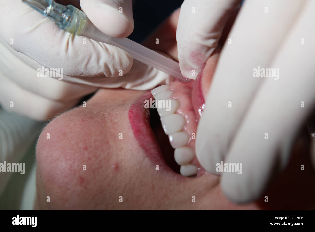 Pain relief methods hi-res stock photography and images - Alamy