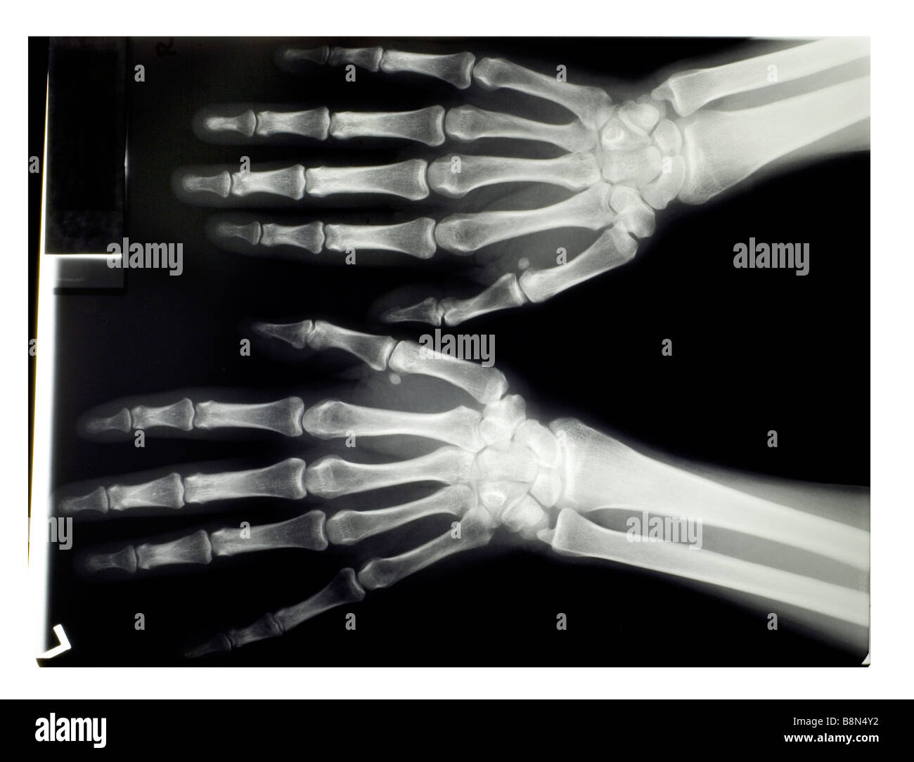 X ray fingers hi-res stock photography and images - Alamy