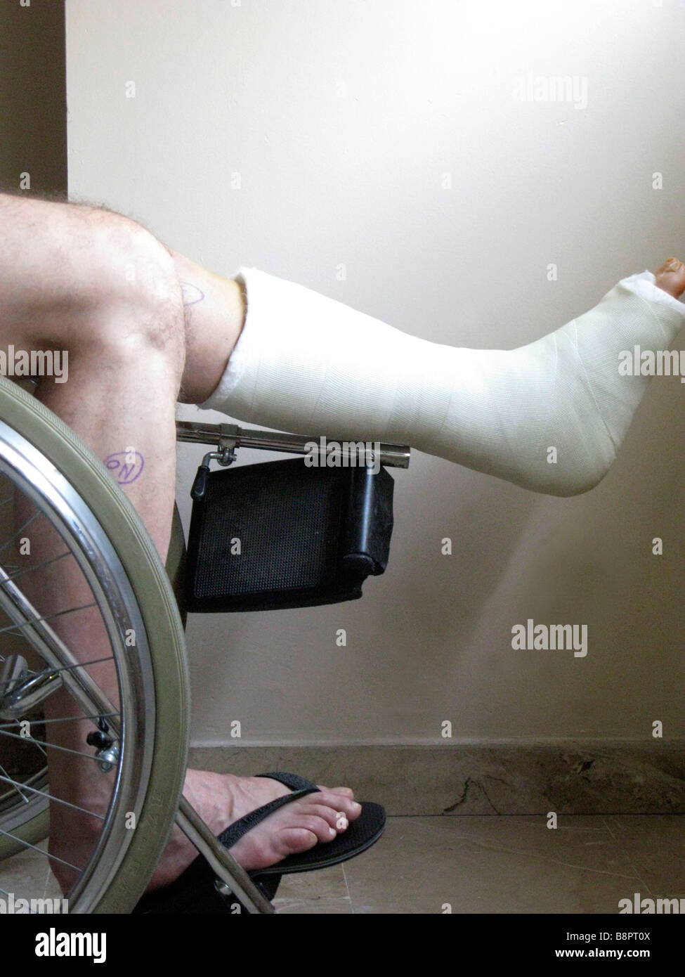 Plaster cast hi-res stock photography and images - Alamy