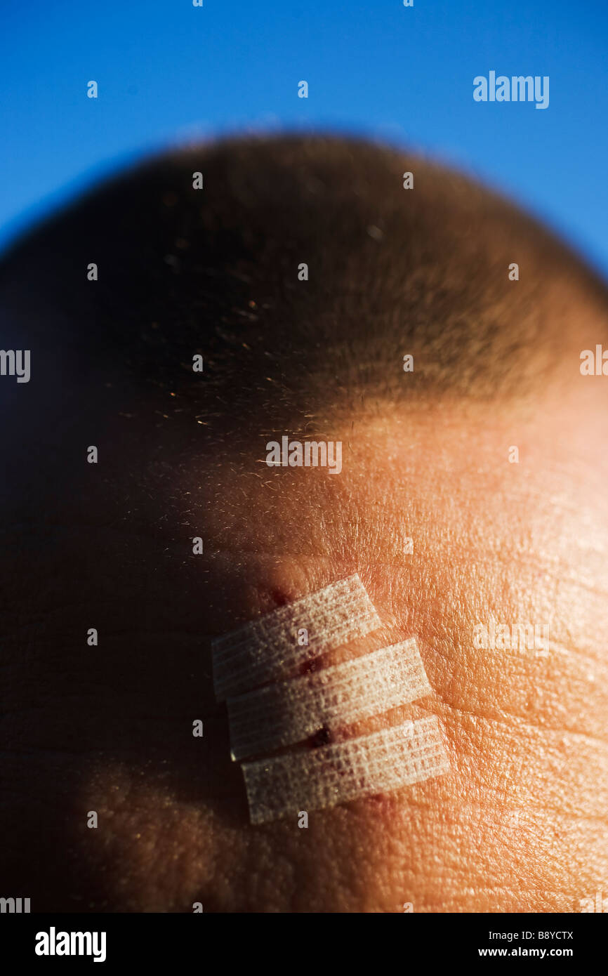 A man having a plaster on his forehead Sweden Stock Photo - Alamy