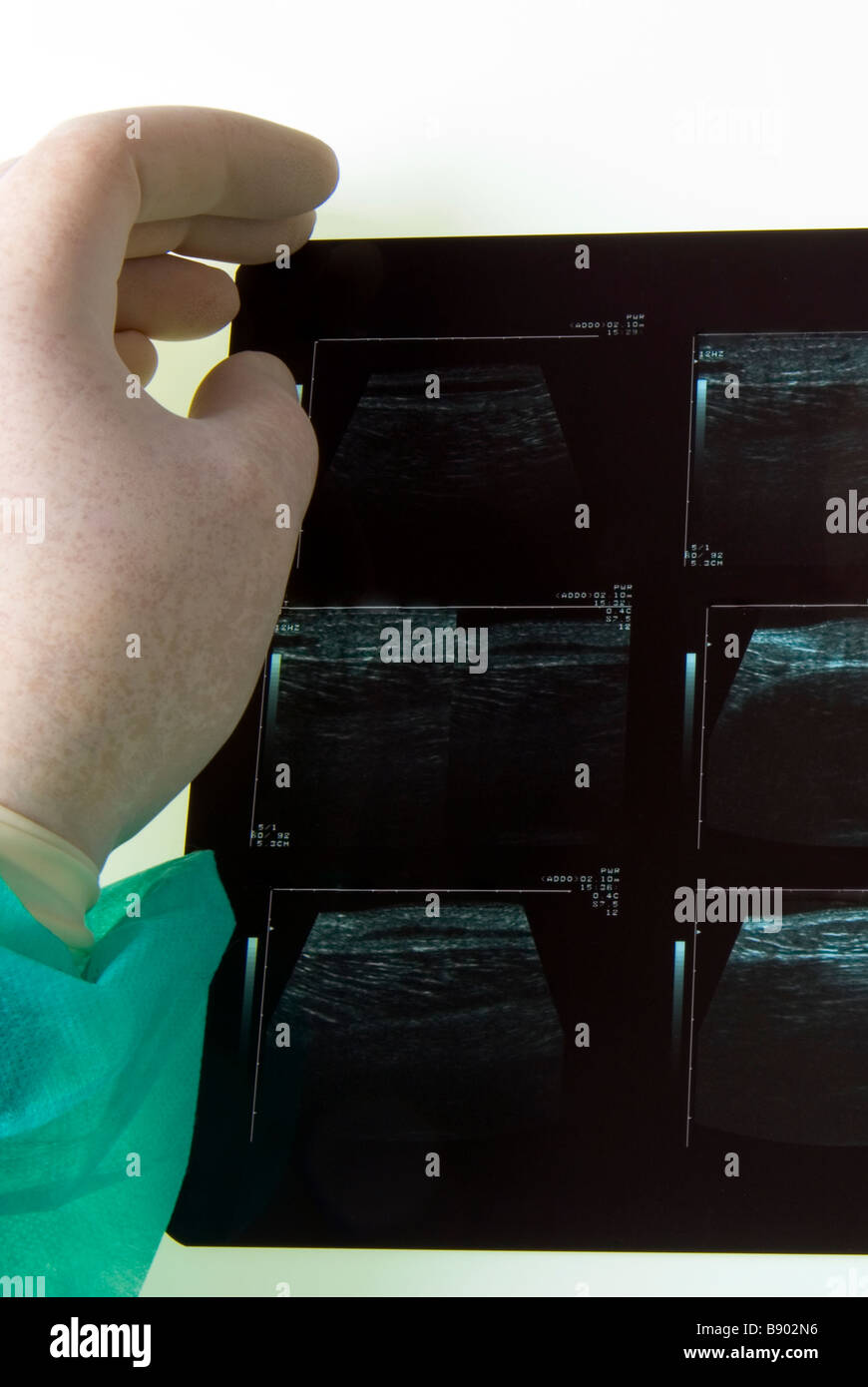 Ultrasonagram hi-res stock photography and images - Alamy