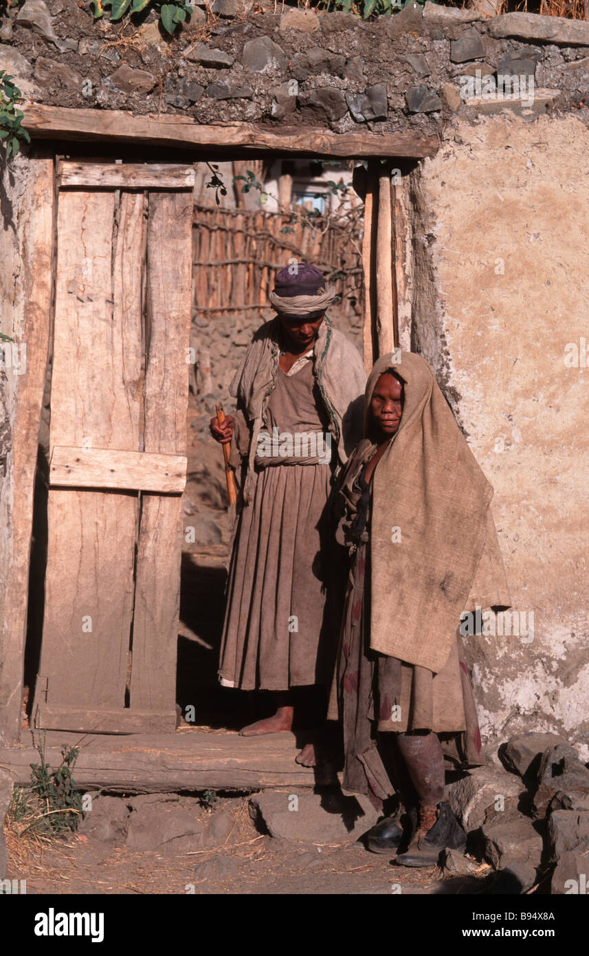 Ethiopia leper hi-res stock photography and images - Alamy