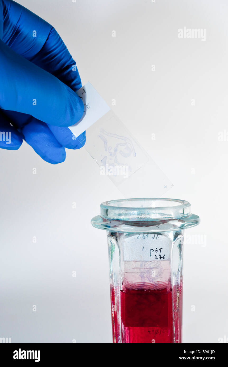 Forensic pathology hi-res stock photography and images - Alamy