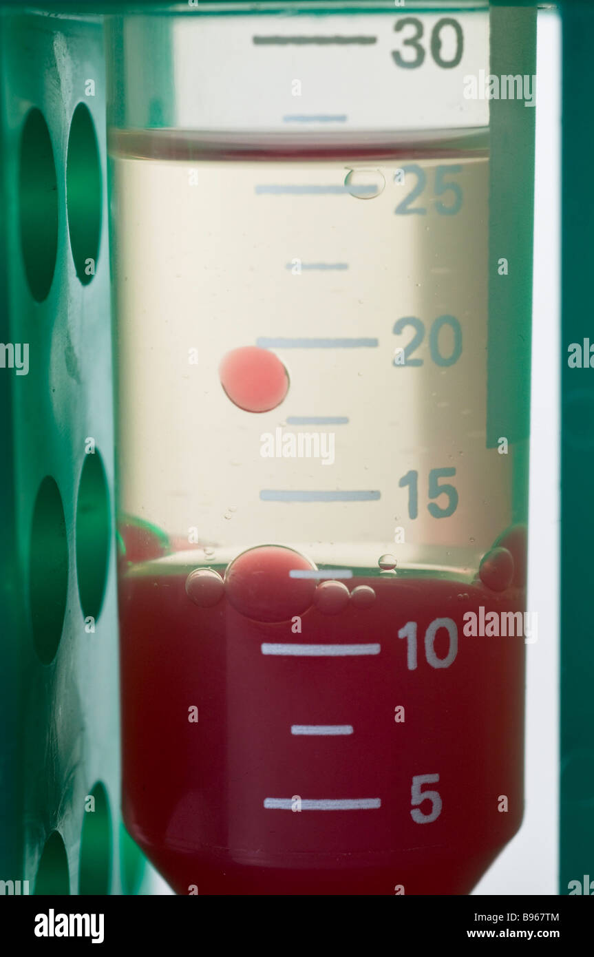 Blood separation hi-res stock photography and images - Alamy