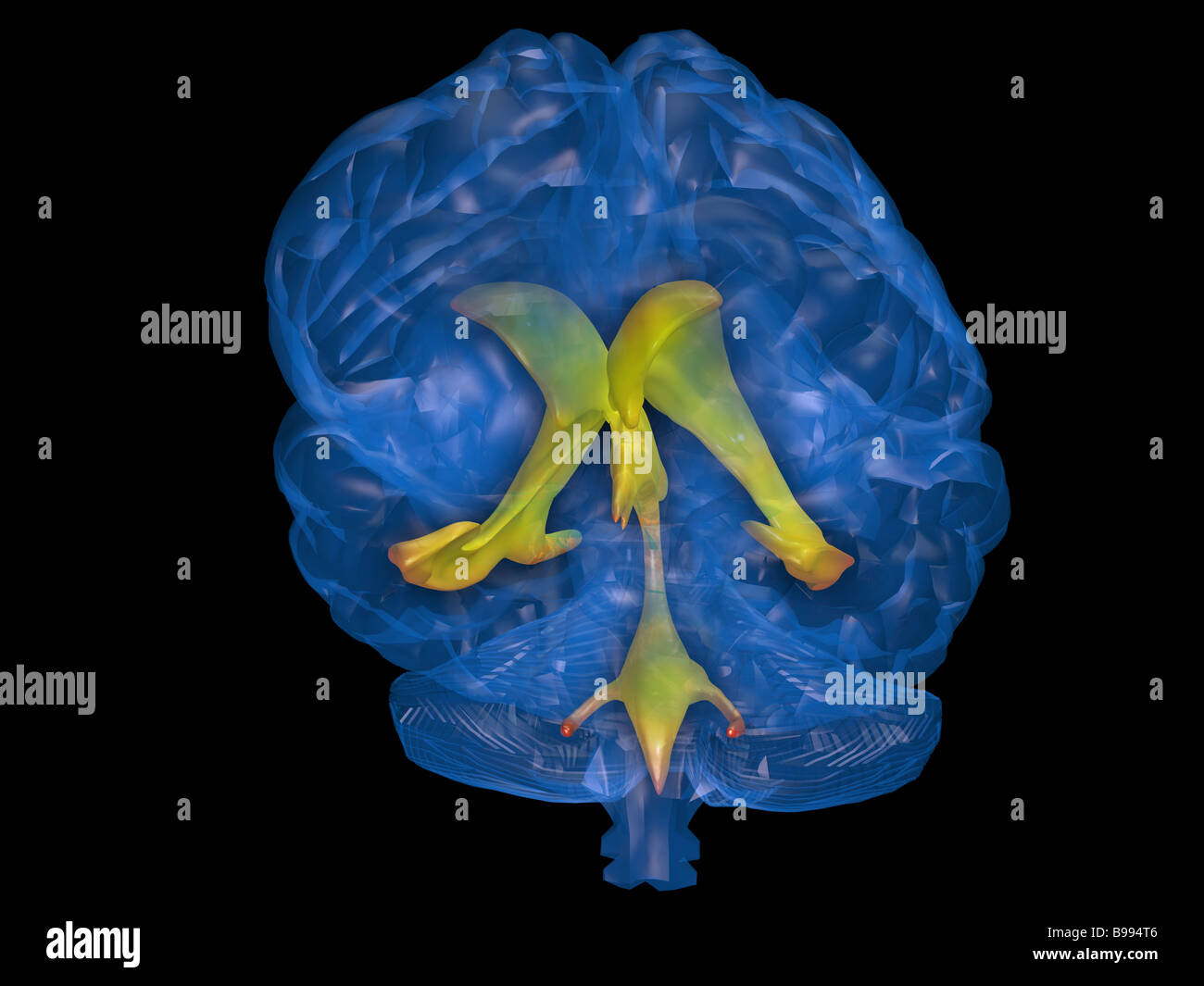 Ventricle of cerebrum High Resolution Stock Photography and Images - Alamy