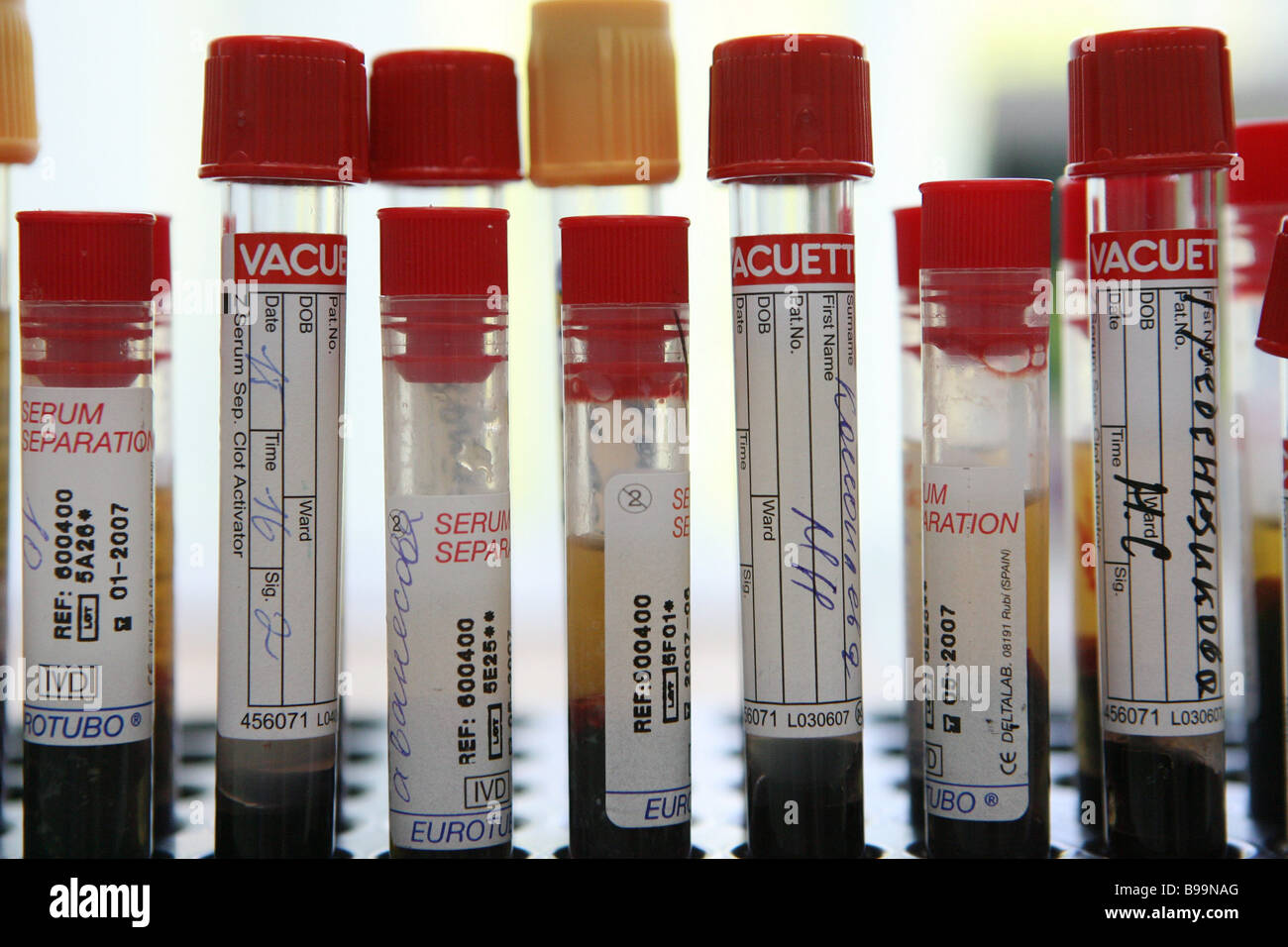 Blood sample vacuum tubes in a private medical laboratory Moscow Stock ...