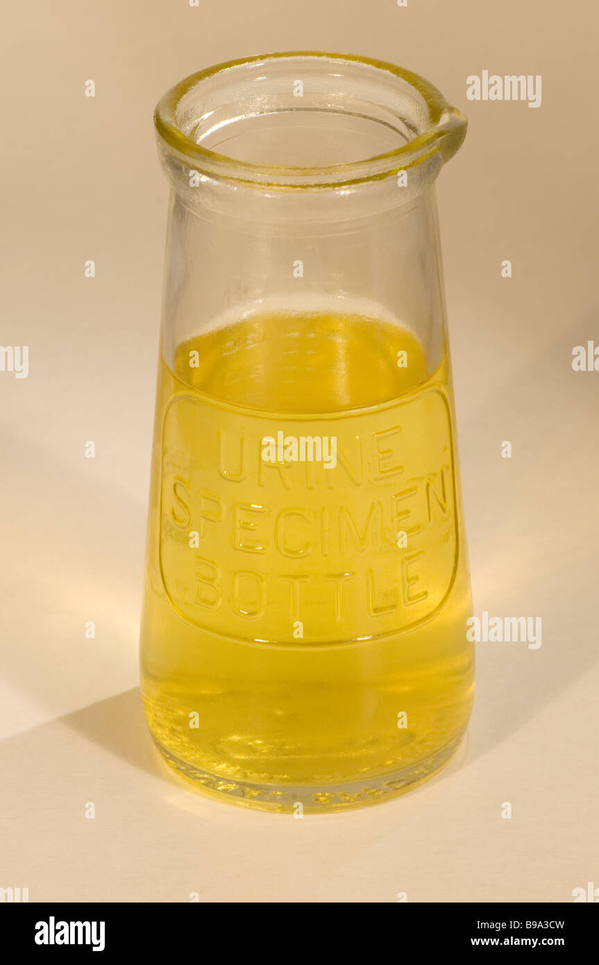 glass jar holding a urine specimen for diagnostic testing Stock Photo ...