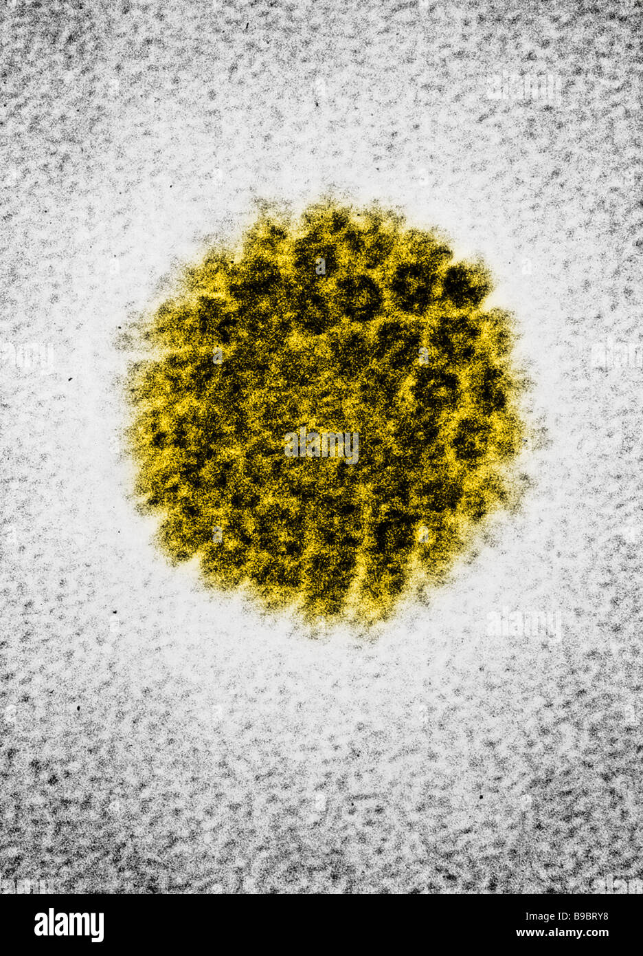 Electron micrograph of a negatively stained human papilloma virus HBV ...