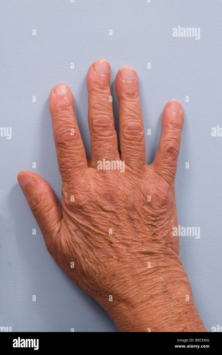Old lady hands close up wrinkles hi-res stock photography and images ...