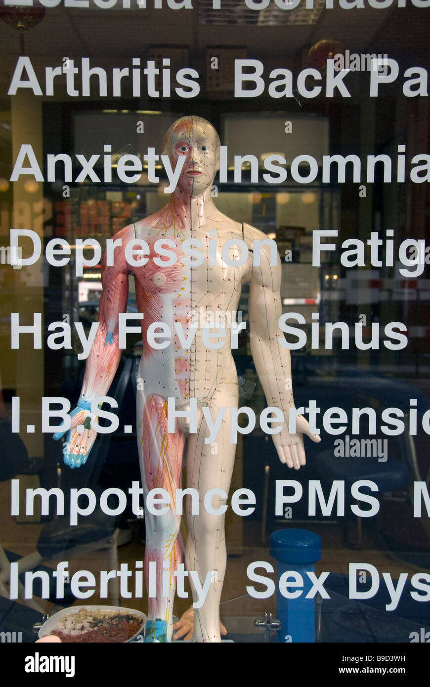 Alternative health window with model marked with acupoints Stock Photo ...