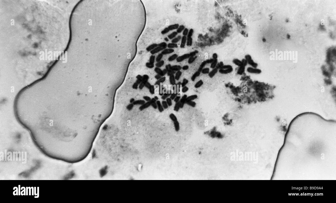 Microscope Wheat High Resolution Stock Photography and Images - Alamy