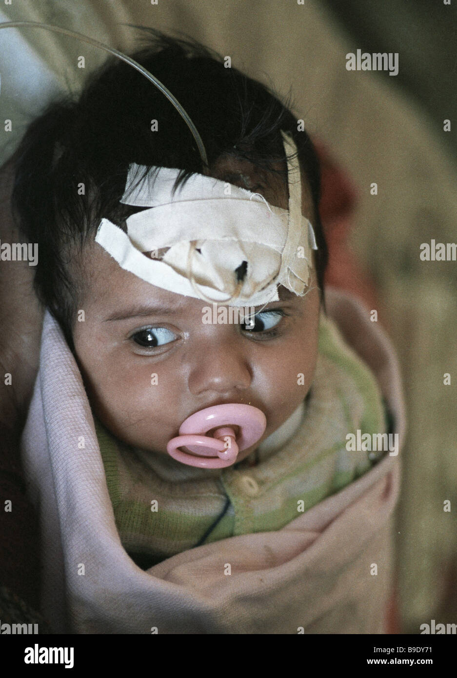 A wounded child in Kabul children s hospital Stock Photo - Alamy