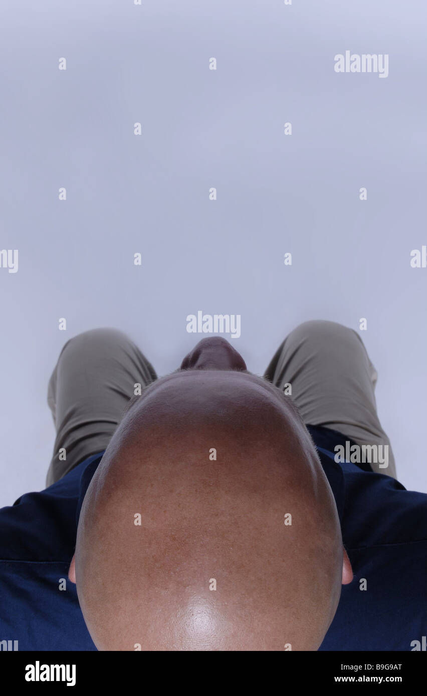 Sits man bald head top view broached people waits wait head scalp ...