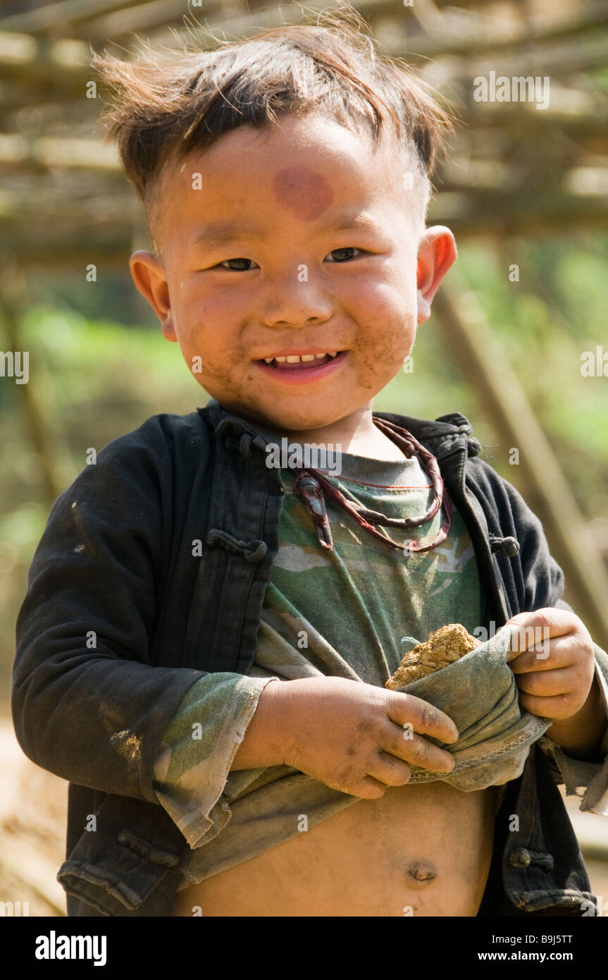 Hmong boy with local healing print on his forehead in Sapa Vietnam ...