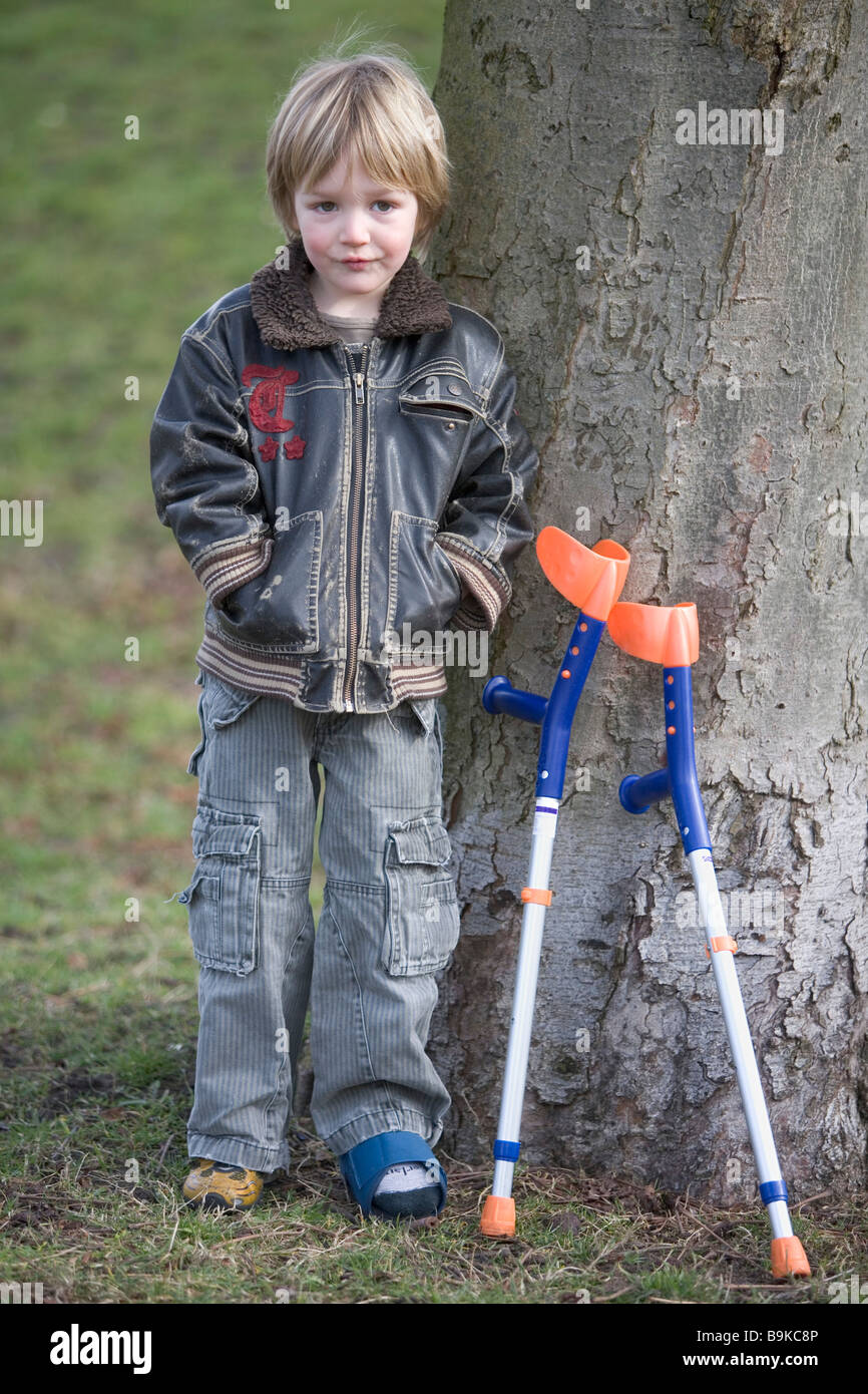 Little boy with a broken leg Stock Photo - Alamy
