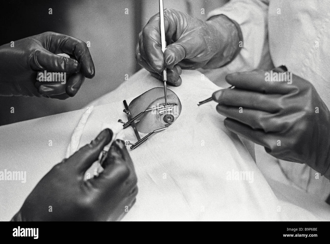 Doctors operating on an eye Stock Photo - Alamy