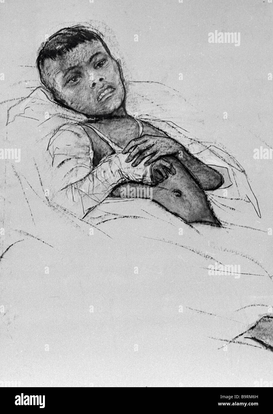 Reproduction of drawing Boy Wounded by Cluster Bomb From Thanh Hoa by ...
