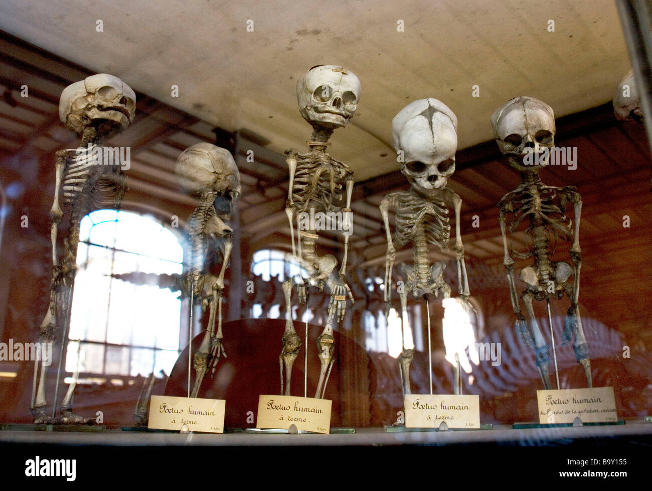 Skeletons of unborn babies on display at the Museum of Natural History ...