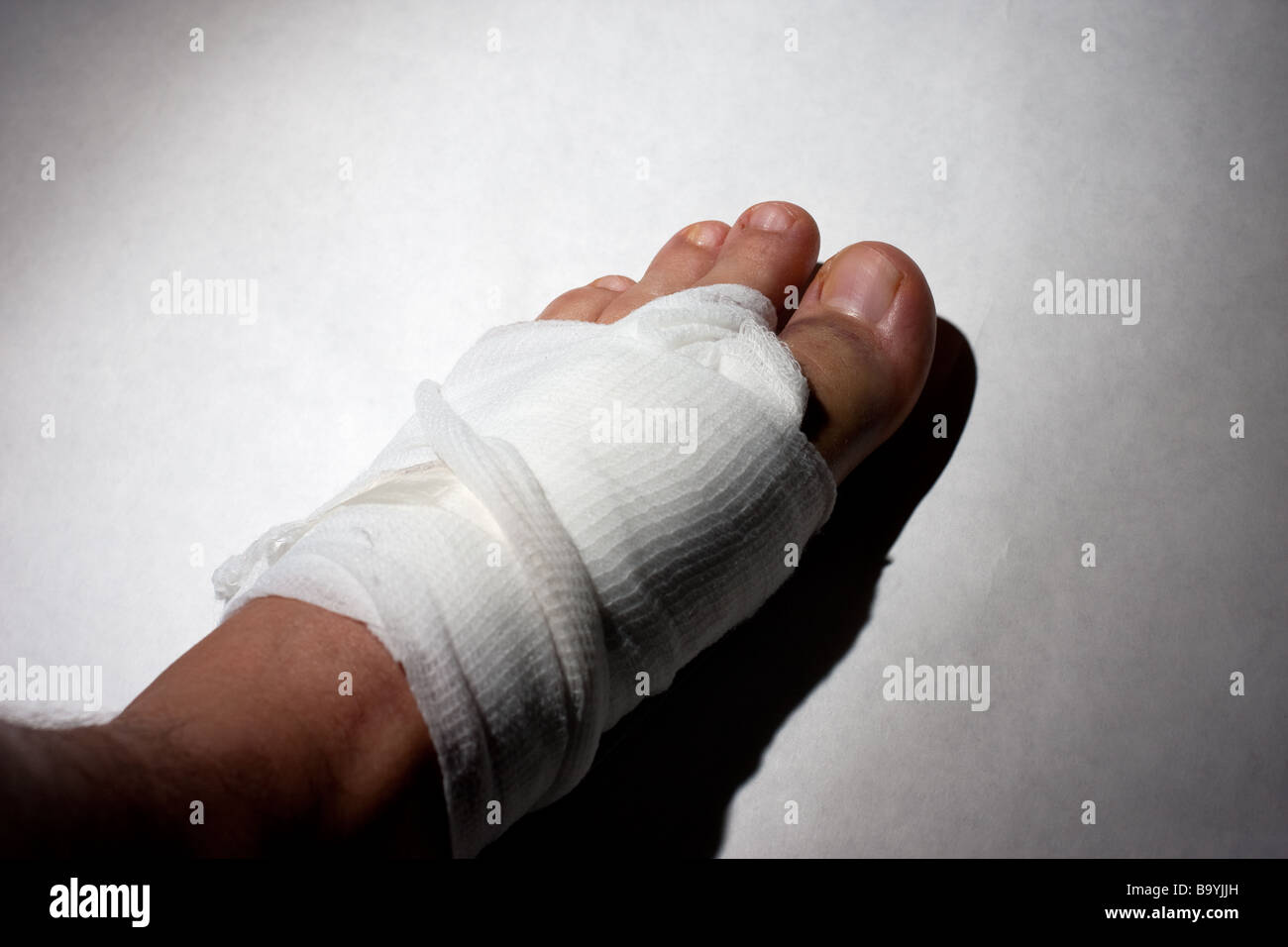 Hallux Rigidus Football Clipart