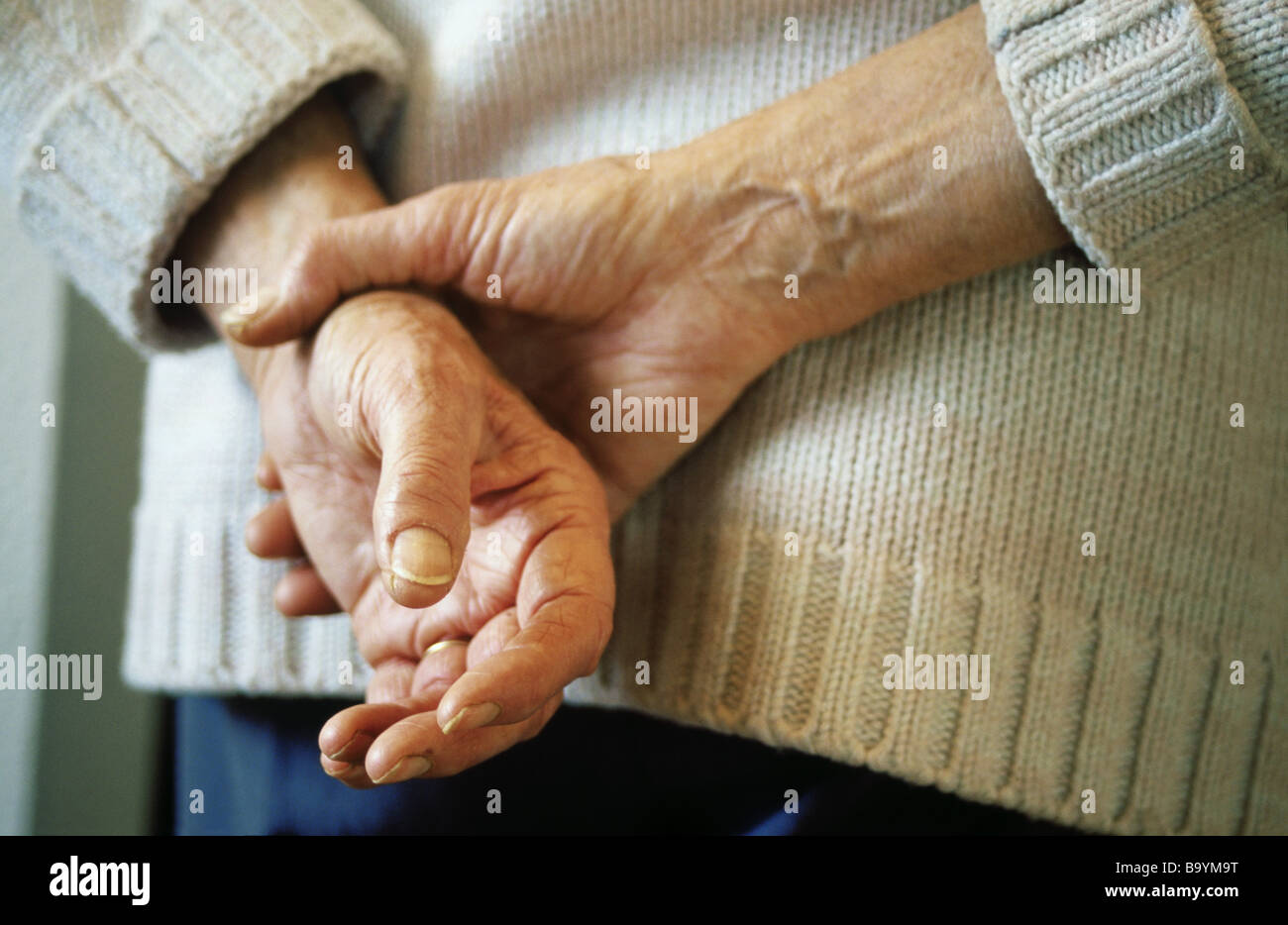 Hautfalten hi-res stock photography and images - Alamy