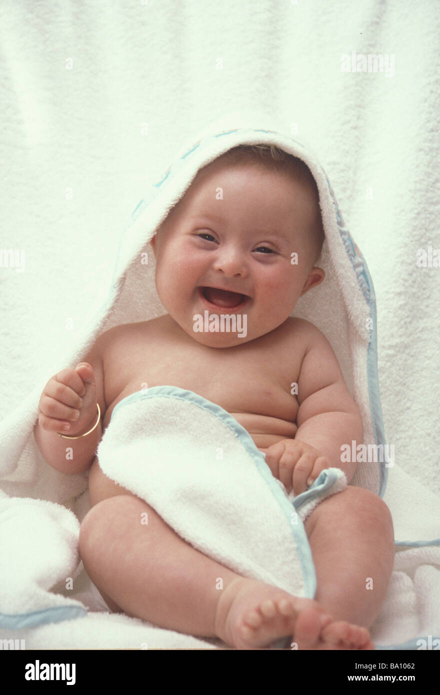 Baby down syndrome smiling hi-res stock photography and images - Alamy