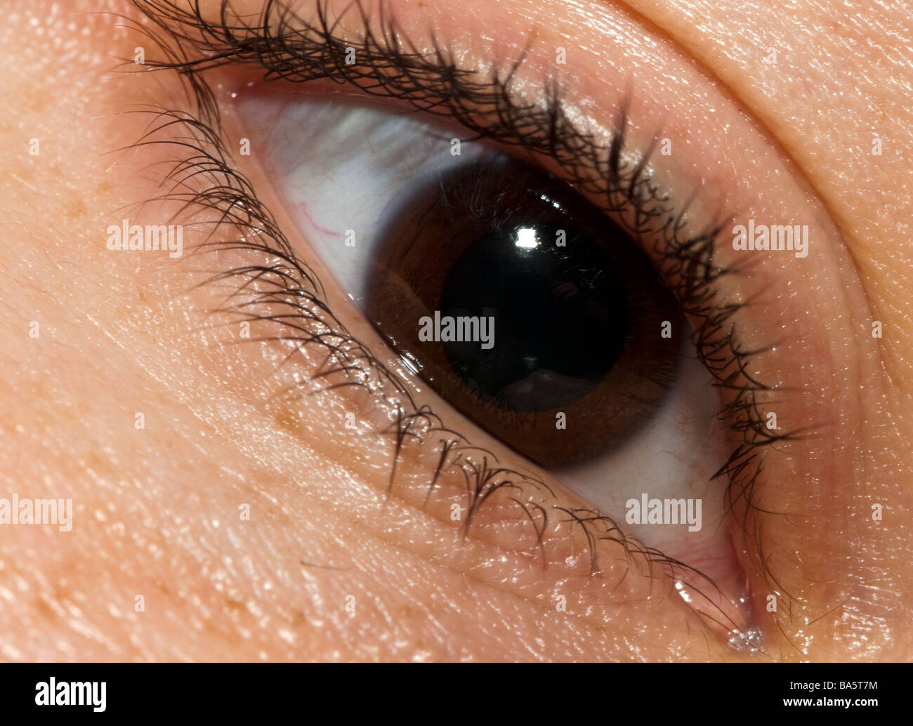 Without eye hi-res stock photography and images - Alamy