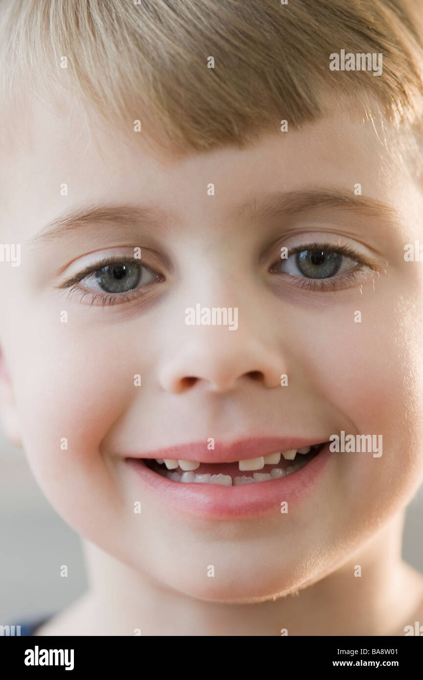 Portrait of boy with missing teeth Stock Photo - Alamy