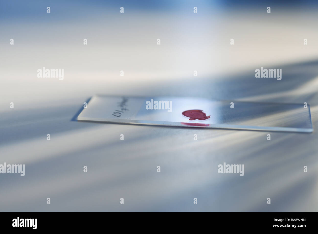 Drop of blood on slide Stock Photo - Alamy