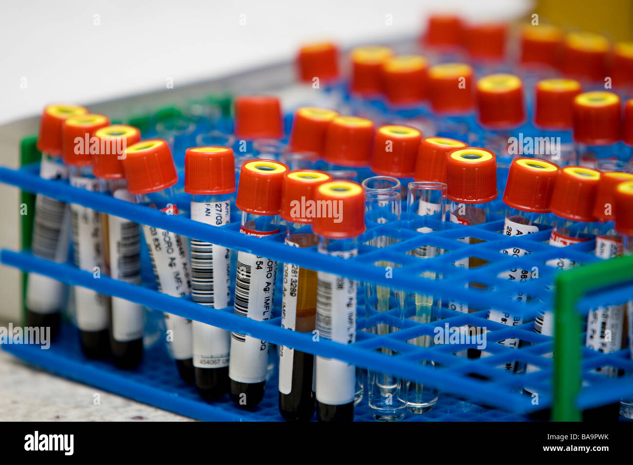 Blood test hi-res stock photography and images - Alamy