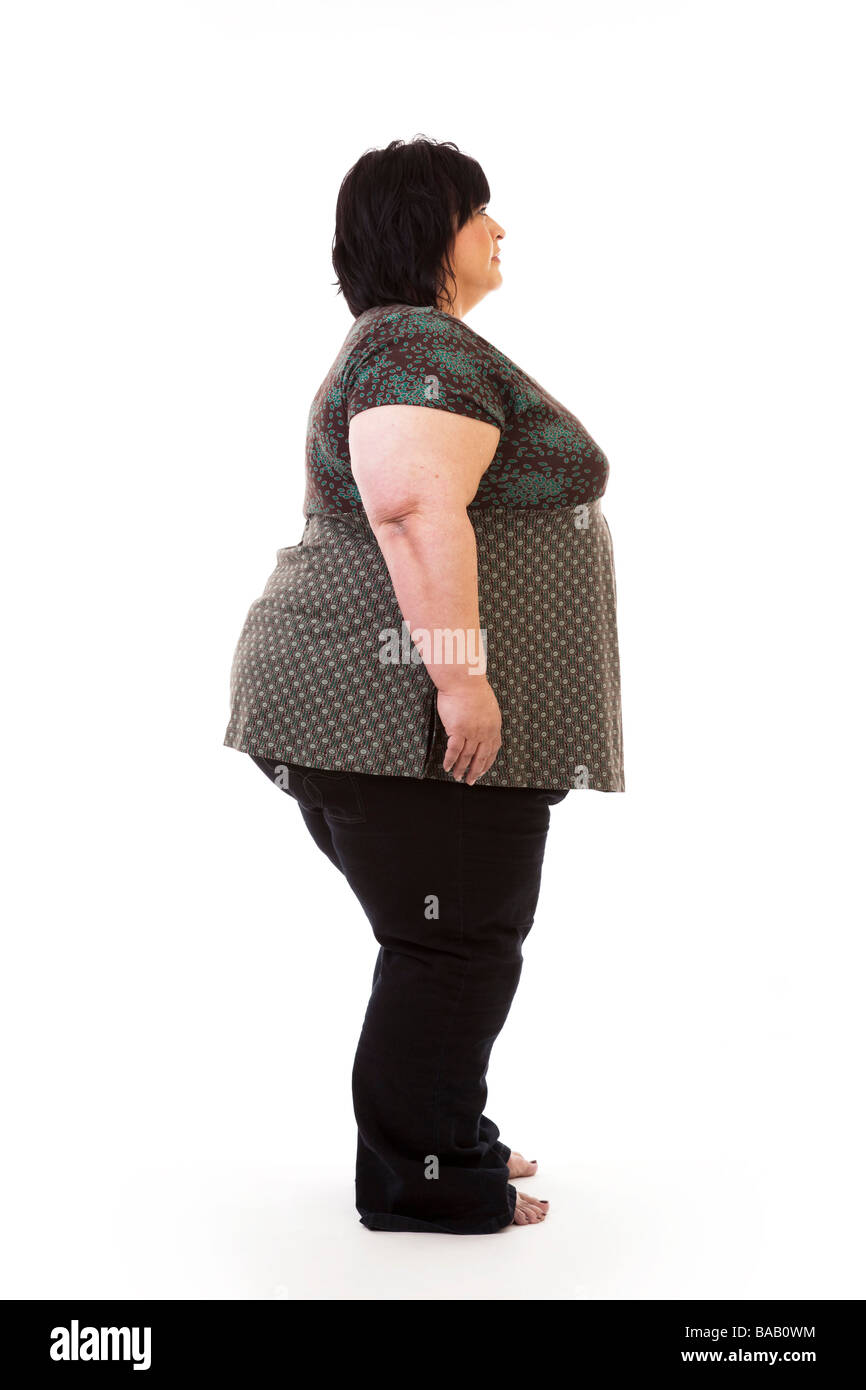Grossly Obese Stock Photos & Grossly Obese Stock Images - Alamy