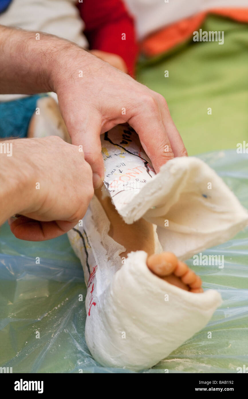 Leg plaster cutting hi-res stock photography and images - Alamy