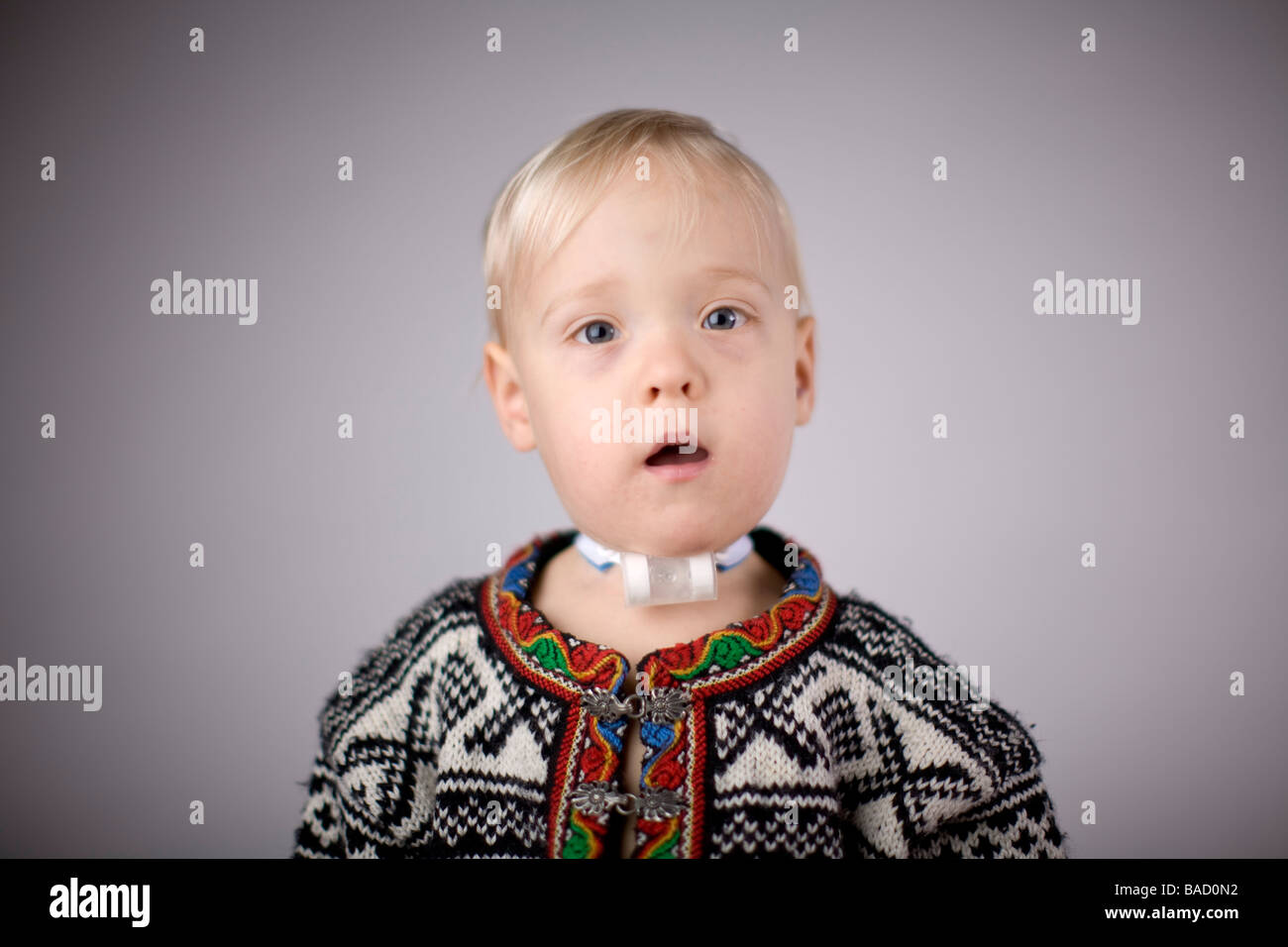 Tracheostomy tracheotomy hi-res stock photography and images - Alamy