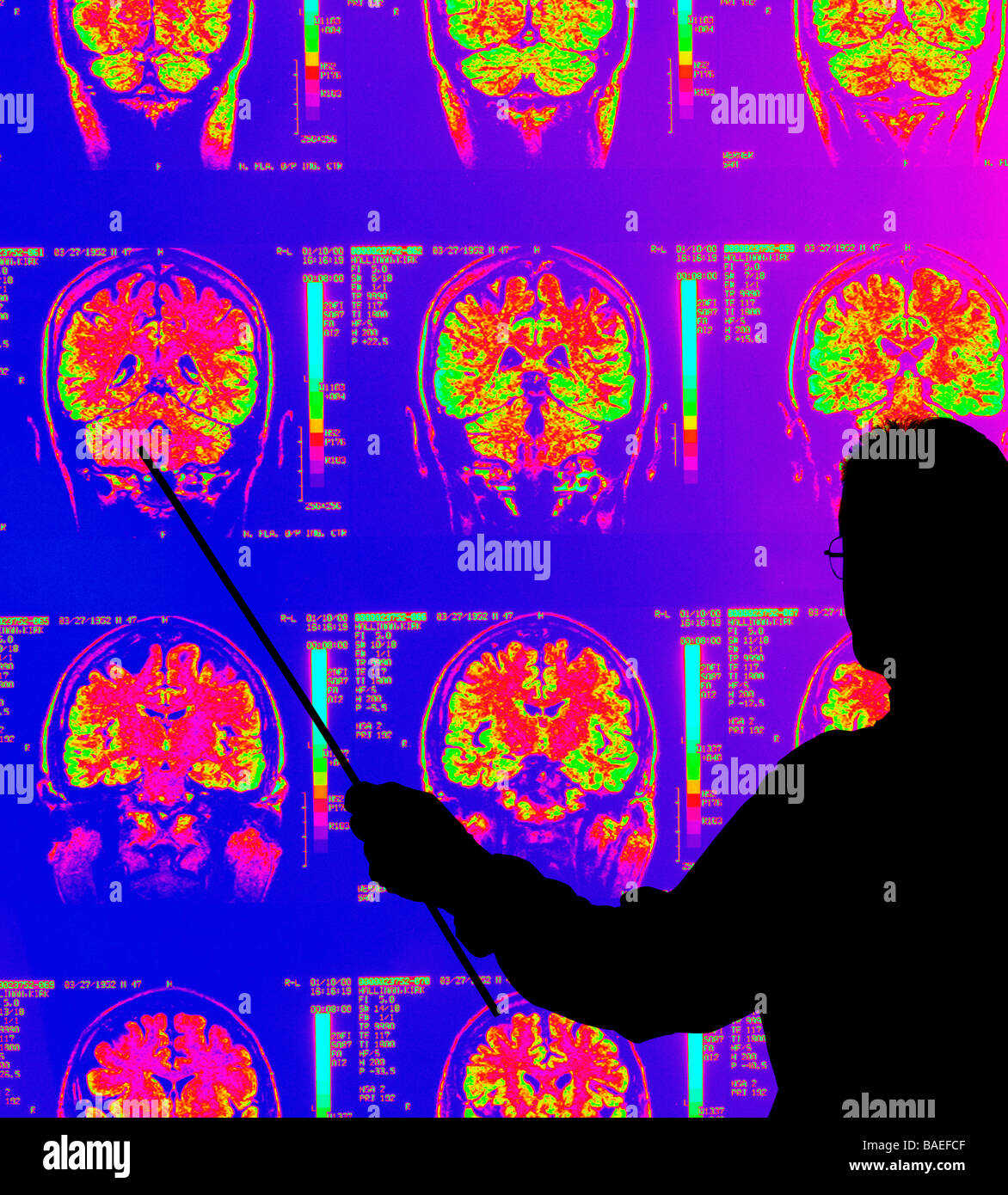 doctor studying MRI projection Magnetic Resonance Imaging Stock Photo ...