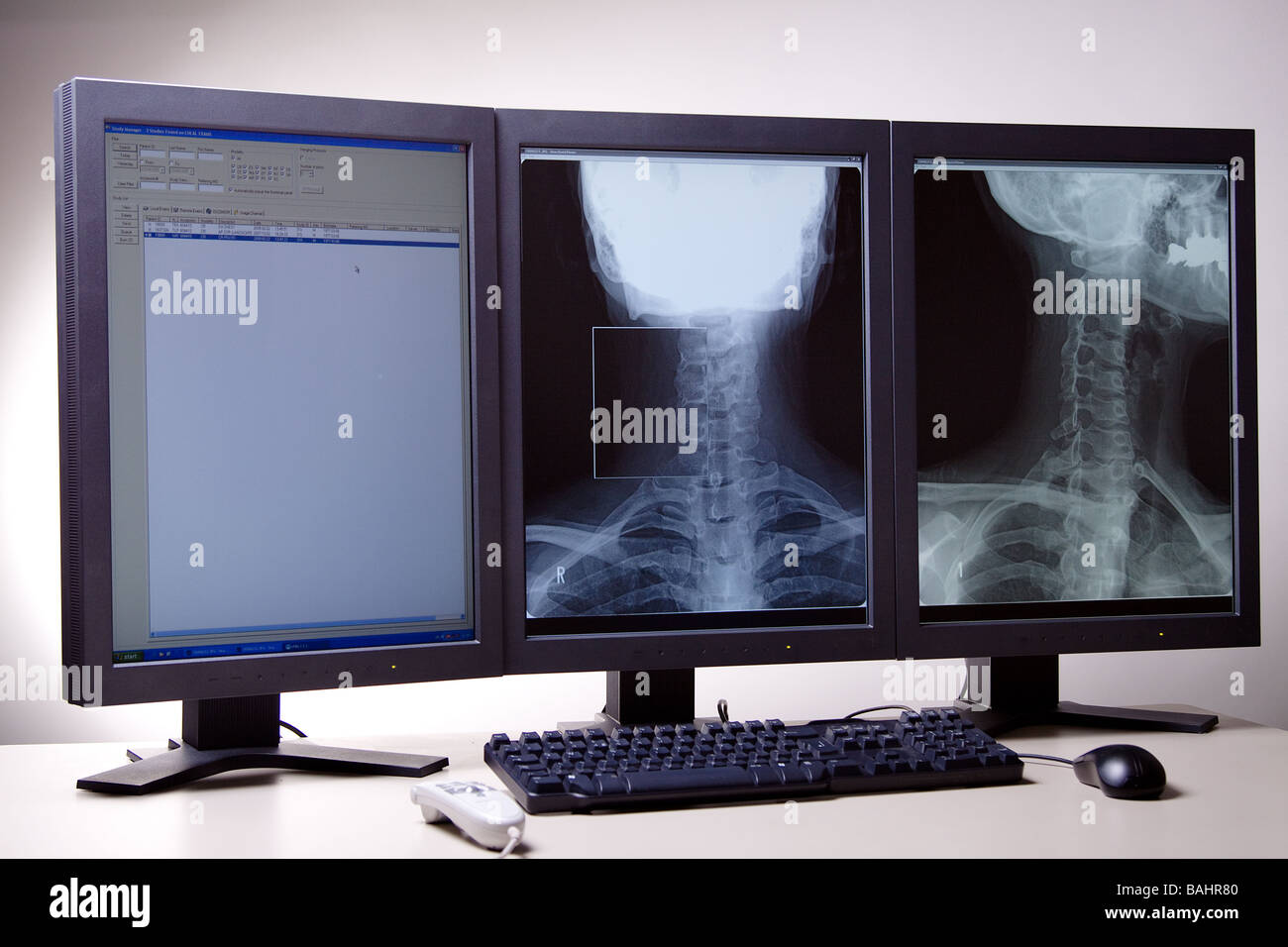 Flat screen medical PACS monitors with keyboard mouse and digital ...