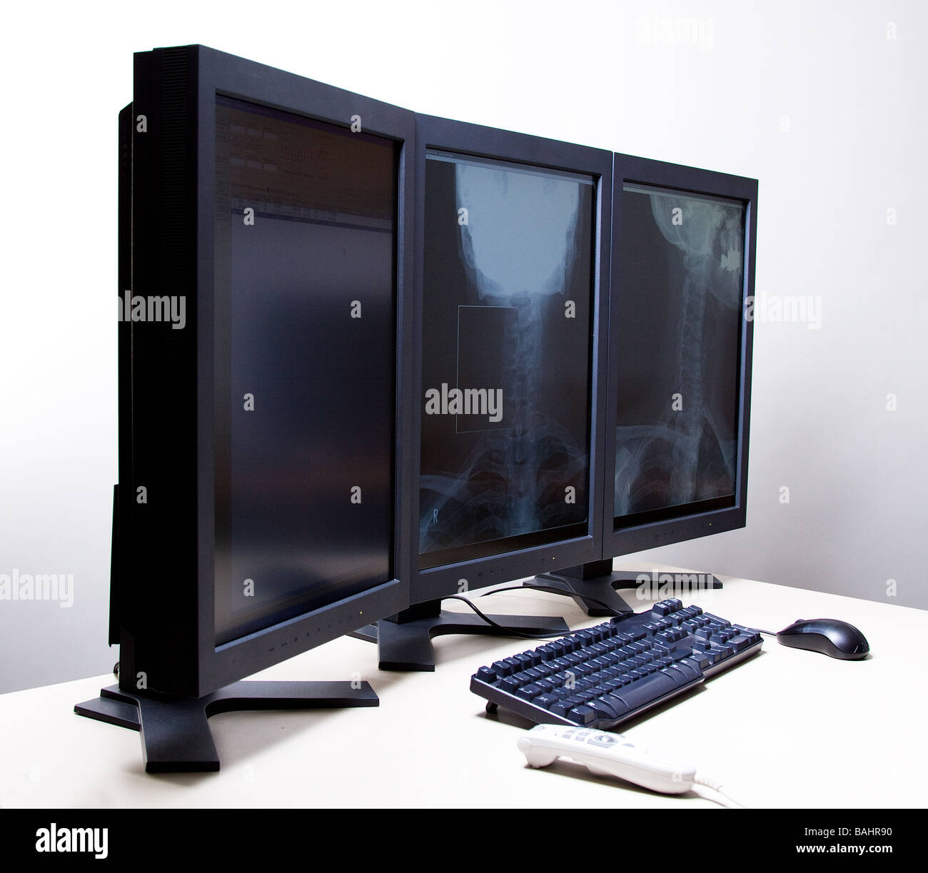 Pacs monitors hi-res stock photography and images - Alamy