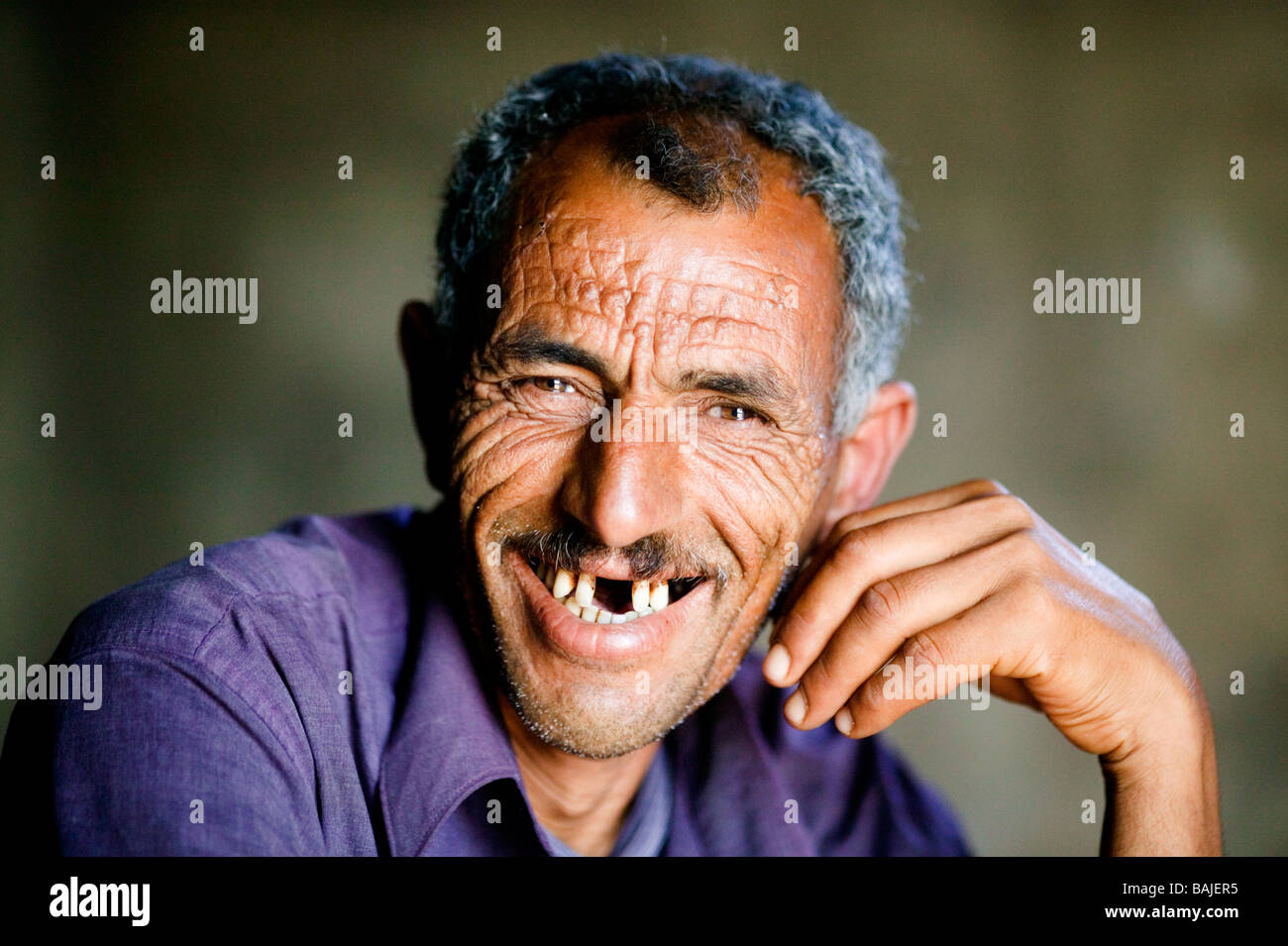 Arab Bad Teeth Shakira Wikipedia